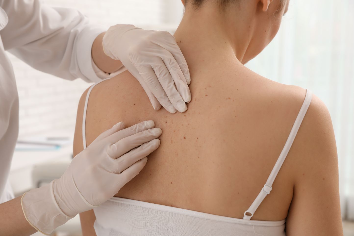 Skin Cancer Near Wharton, TX Near Me El Campo Texas